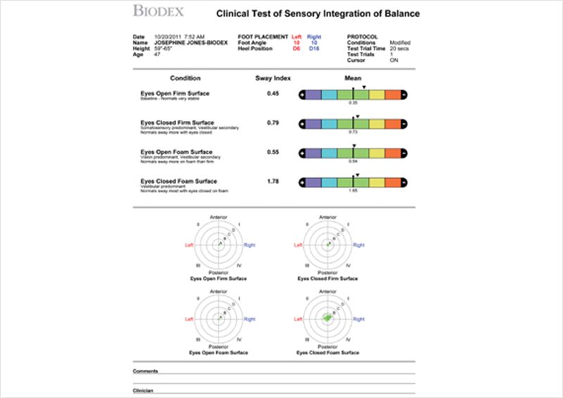 动静态平衡测试训练系统 Balance System SD - 广州睿康医疗器械有限公司